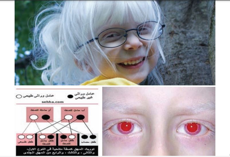 Risks of changing eye color – Royal Spanish Center